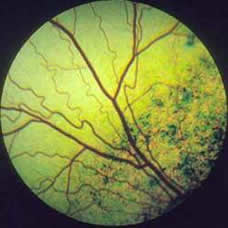 prcd-PRA-Progressive Retinaatrophie - Yellowstone Australian Shepherds